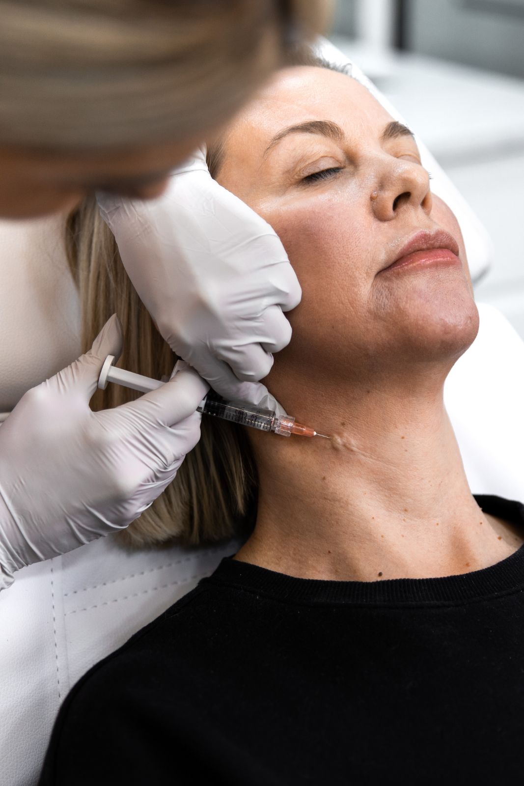 SLA PROFHILO - SLA MEDICAL CLINIC – SLA Medical Shop