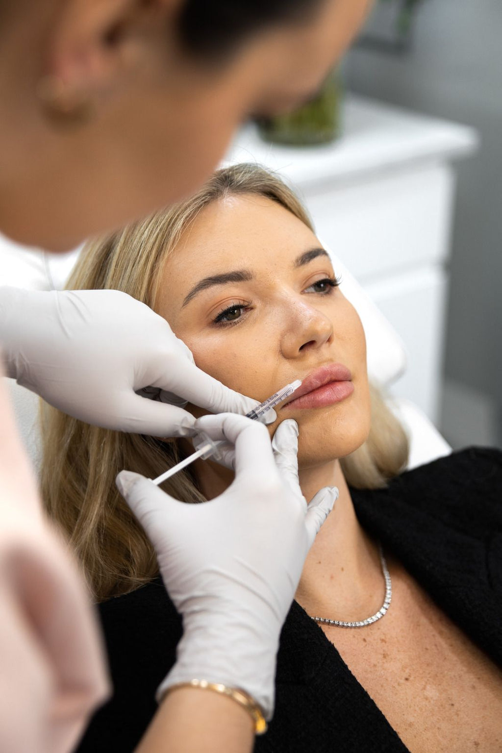 SLA LIP ENHANCEMENT - SLA MEDICAL CLINIC – SLA Medical Shop